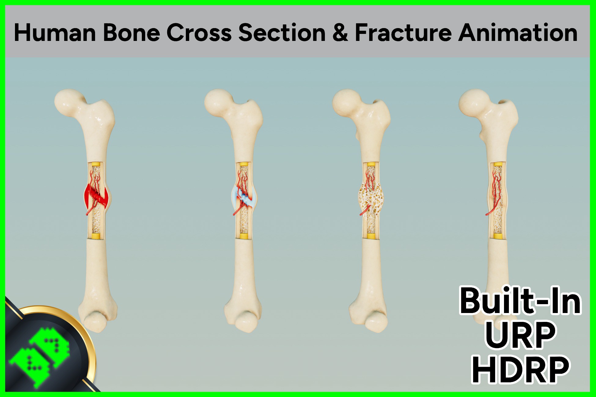 Human Bone Cross Section & Fracture Animation | Characters | Unity Asset Store