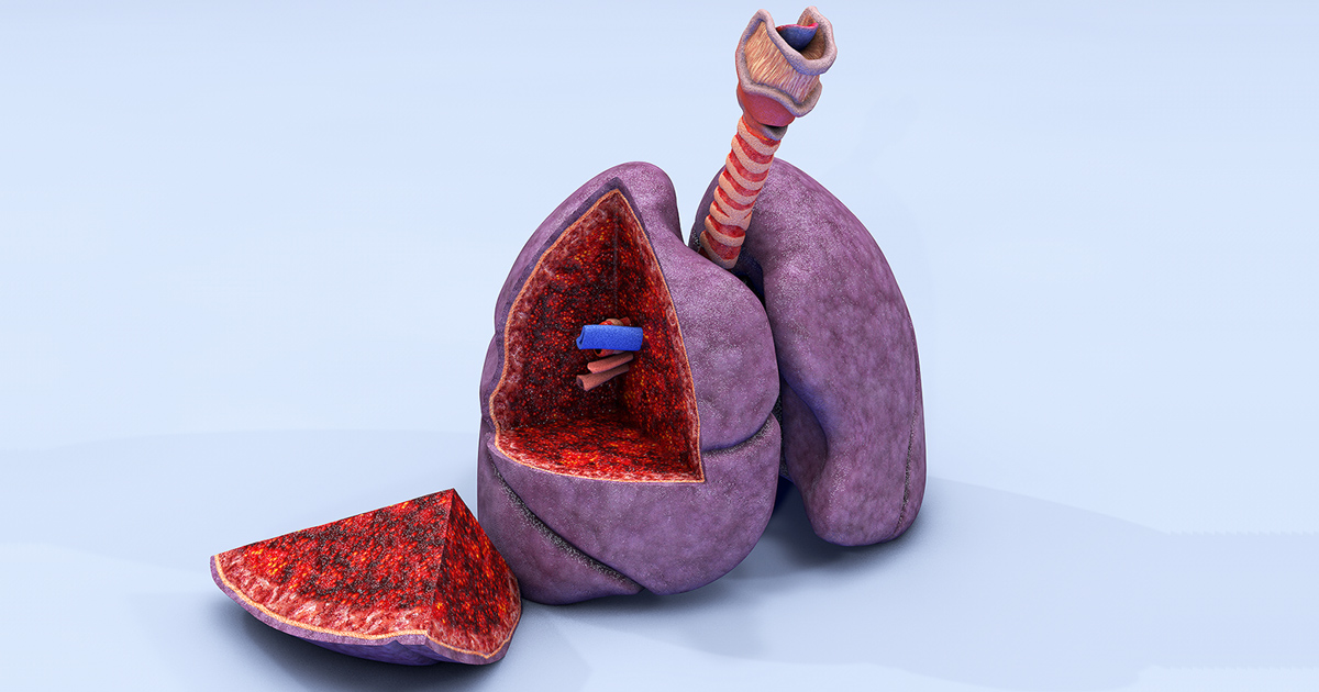 Lungs Dissection Animated Parts | 3D Characters | Unity Asset Store